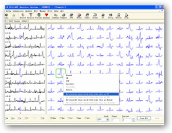 Vasomedical Combined ECG Holter, Ambulatory Blood Pressure/Software ...